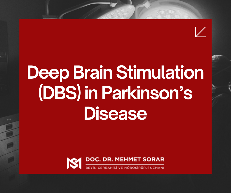 Deep Brain Stimulation (DBS) in Parkinson’s Disease